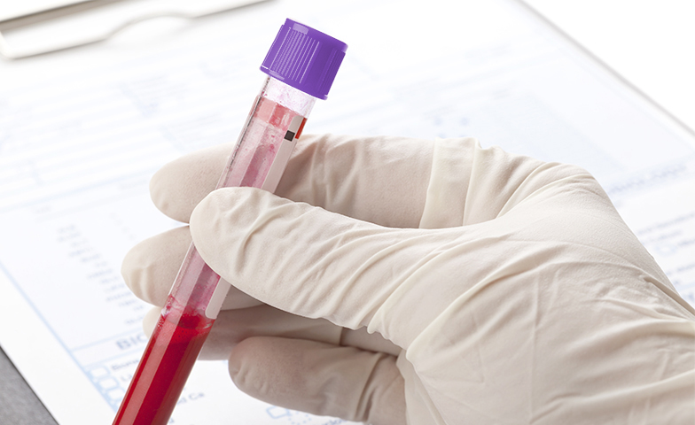 Complete blood count (also – automated blood testing) | Hila