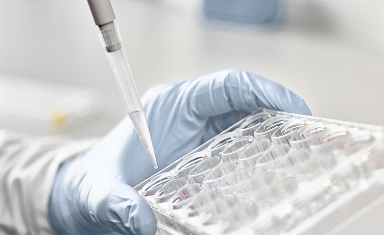 Transferrin saturation test | Hila