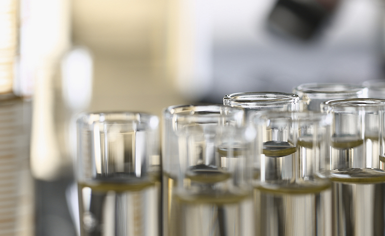 Fosforas (PHOS) | Fosforo tyrimas | Hila