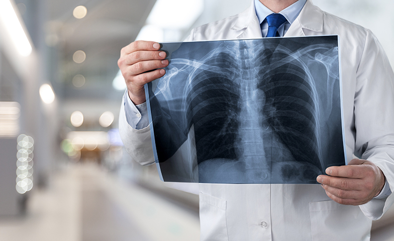 Bronchoskopija kontroliuojant rentgenu | Hila