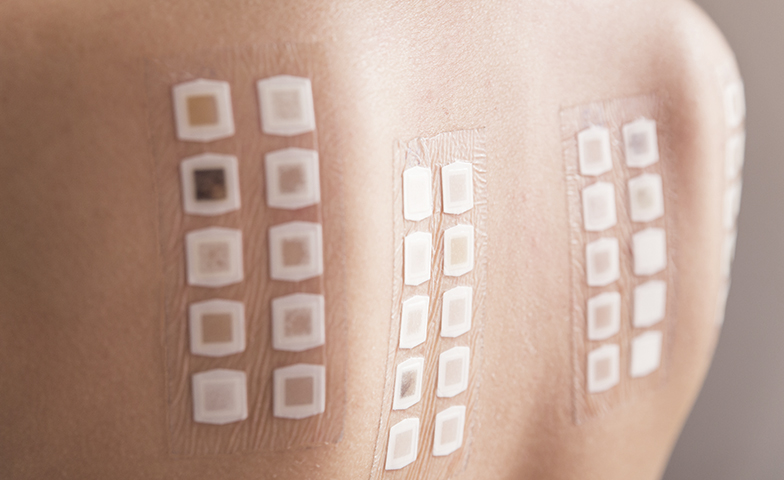 Odos lopo testas (Patch testas) | Hila | Hila