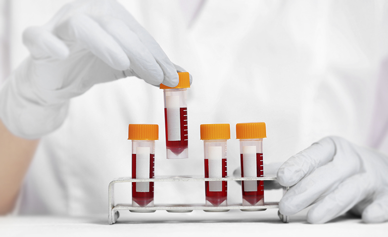 Litis (Li) | Ličio tyrimas | Hila